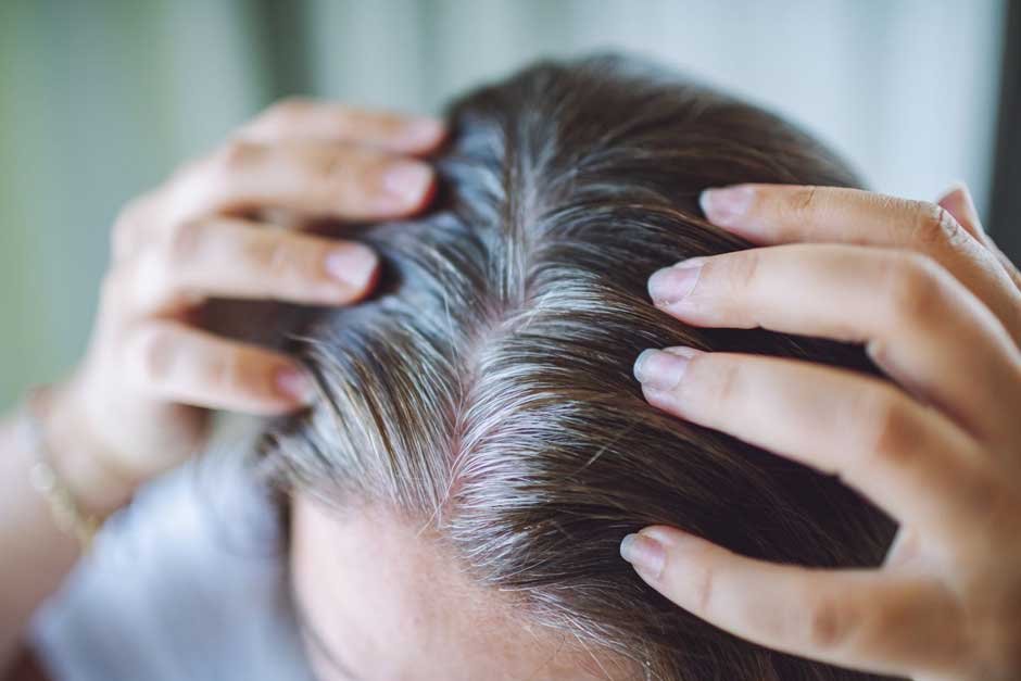 Tried Everything for Your Scalp? These Treatments Might Surprise You ...